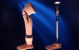 Amputasi: Pengenalan Orthotik dan Prostetik