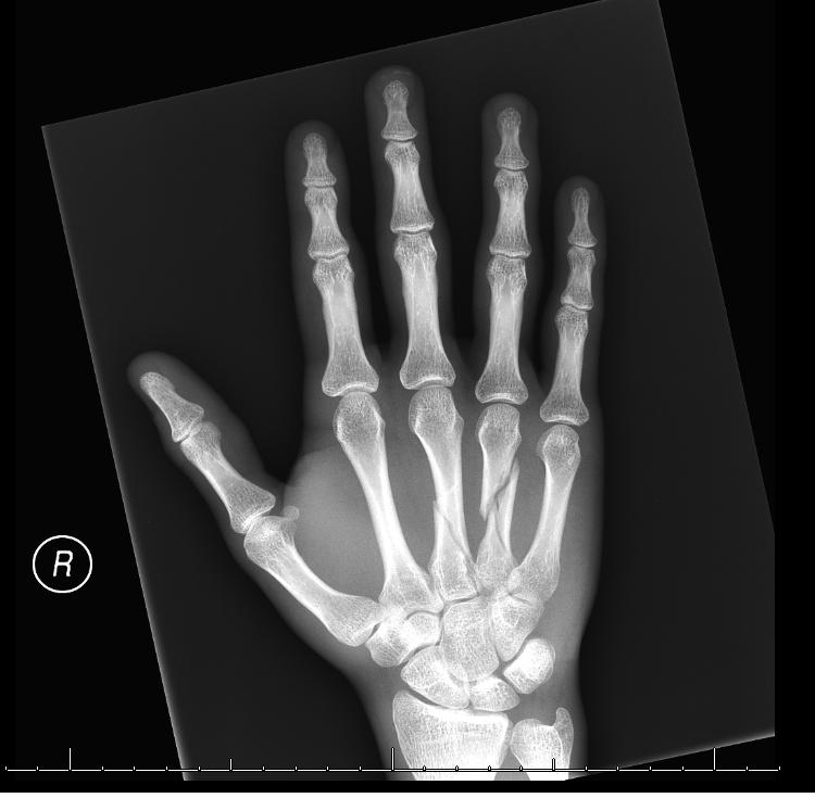 ROB RUIJGH: Valpartij tijdens training