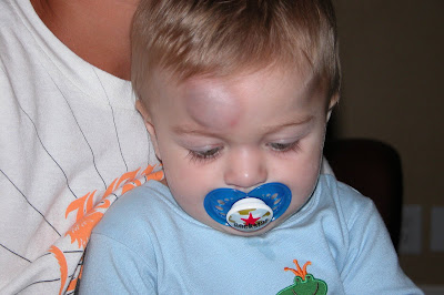 Just a bunch o' Brooks!: SERIOUSLY....has anyone seen a goose egg this ...