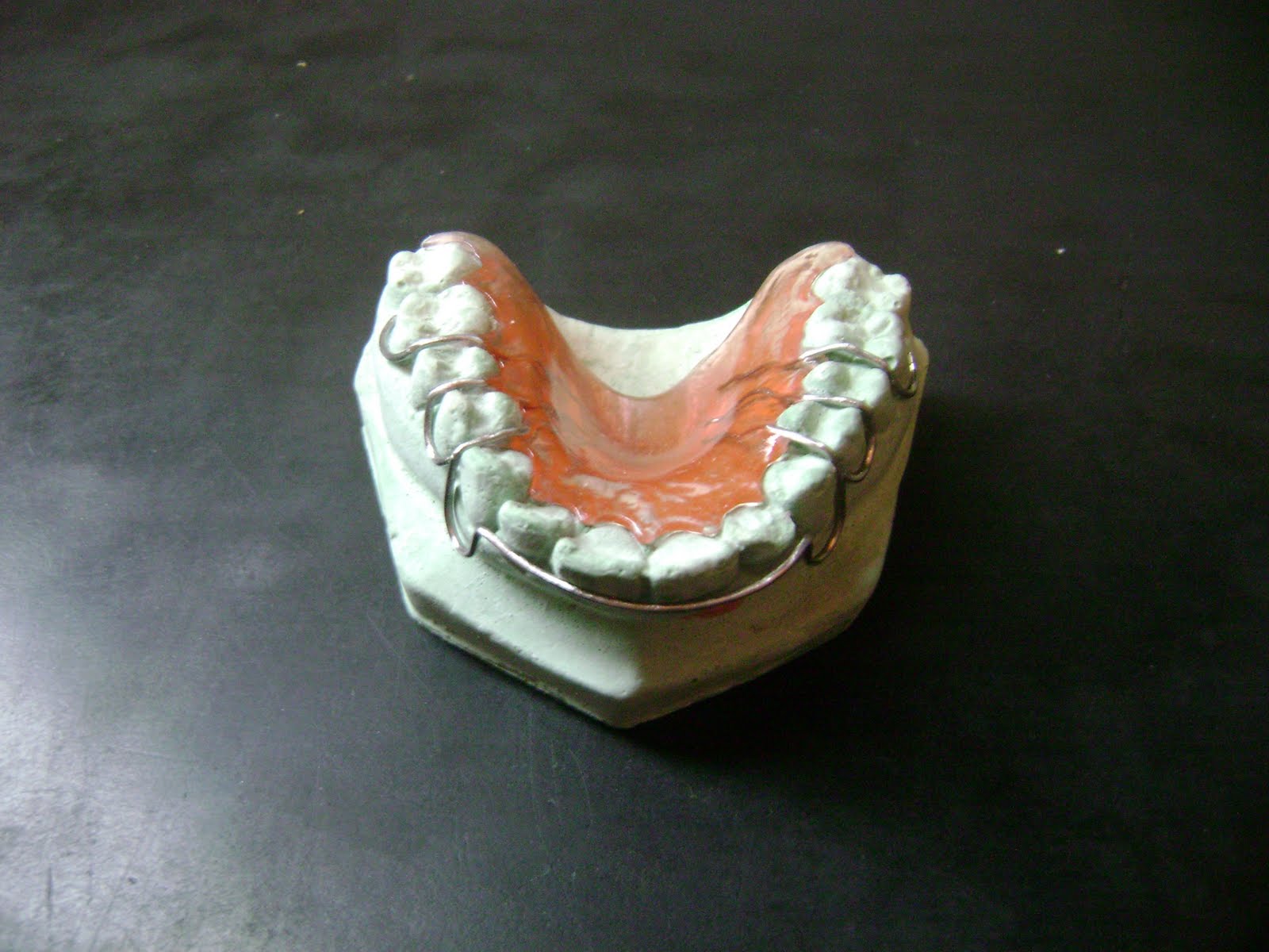 Laboratorio Dental Fernando Emmanueli: Placa Hawley de Contención