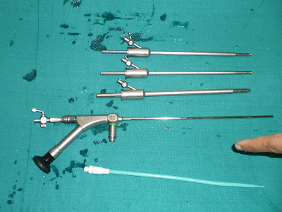 Ramayya Pramila Urology Hospital: PCNL:RIGHT TECHNIQUE AND OVERVIEW