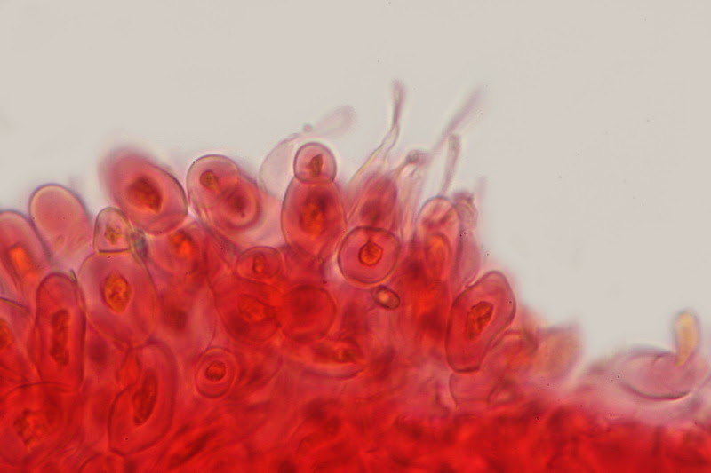 El mundo microscópico de los hongos: Gasteromicetos